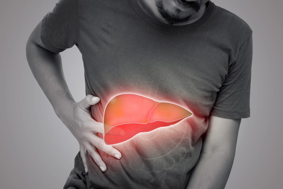 Le cancer du foie - Doqi.fr