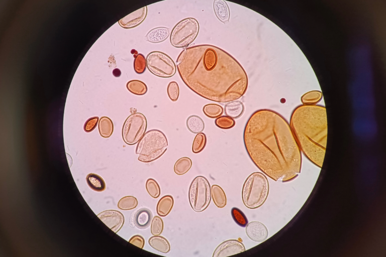 Vers intestinaux : comment détecter et éliminer ces parasites digestifs ...